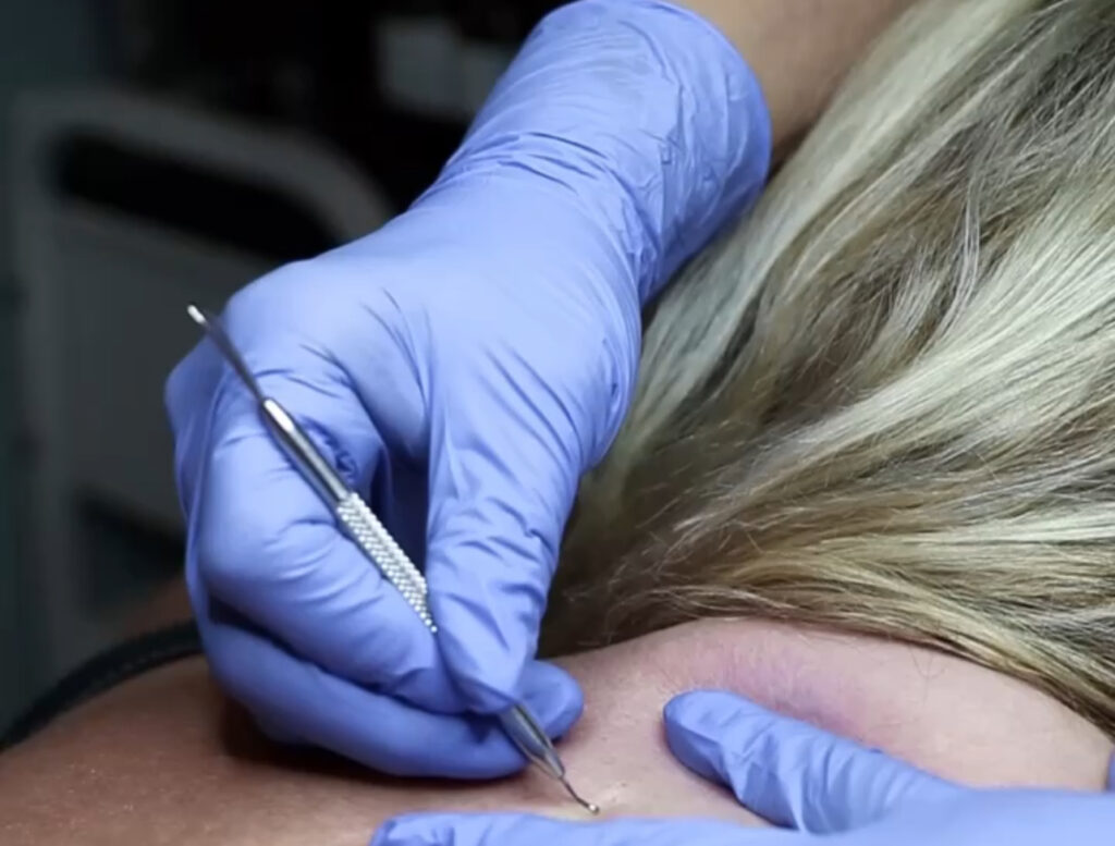 Naples Facial Treatments | Med Spa Facial Services in Naples