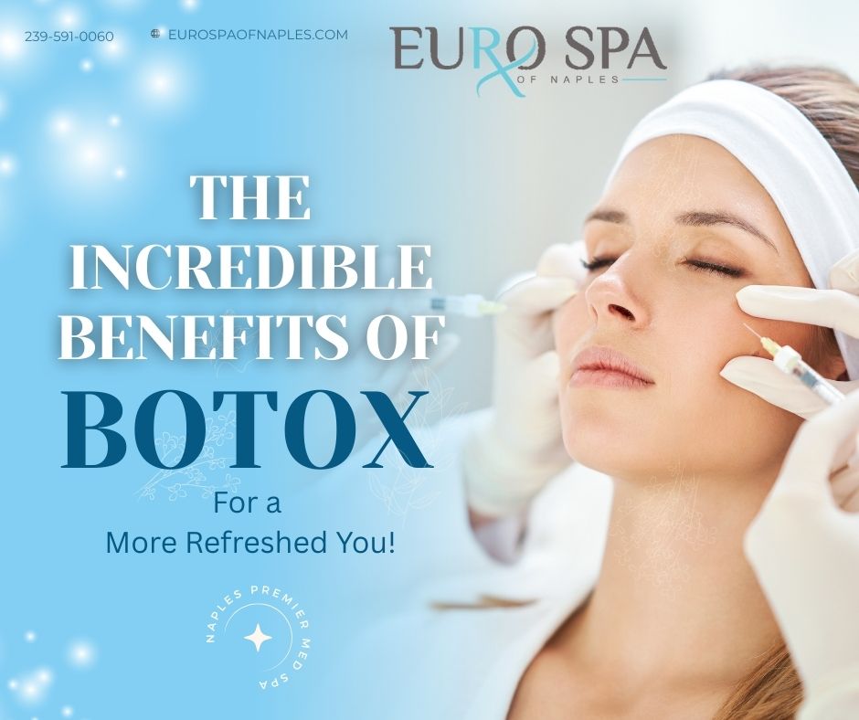 5 Incredible Benefits of Botox for a Youthful Look | Eurospa